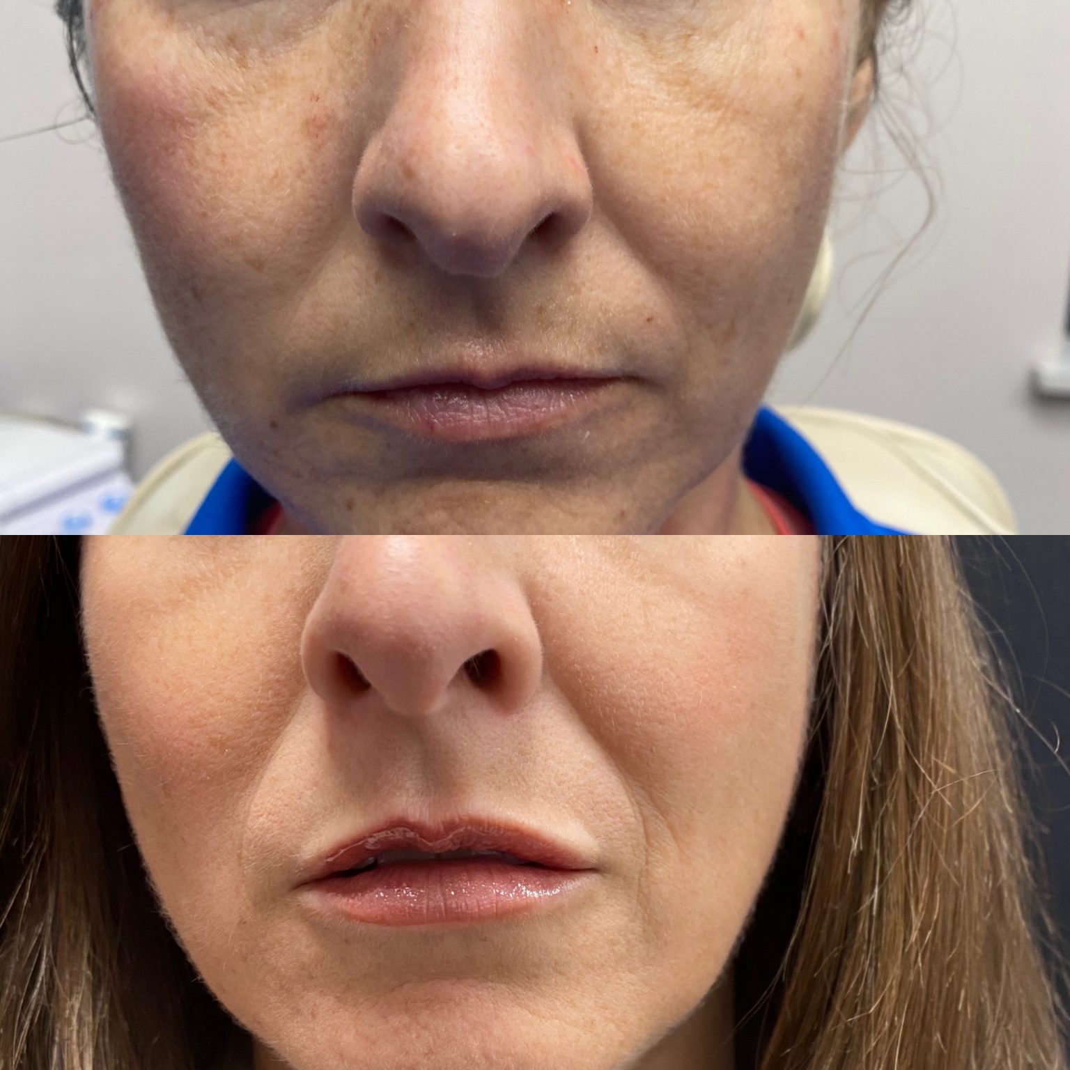 Browse our Before & After Gallery | K2 Restorative Medicine