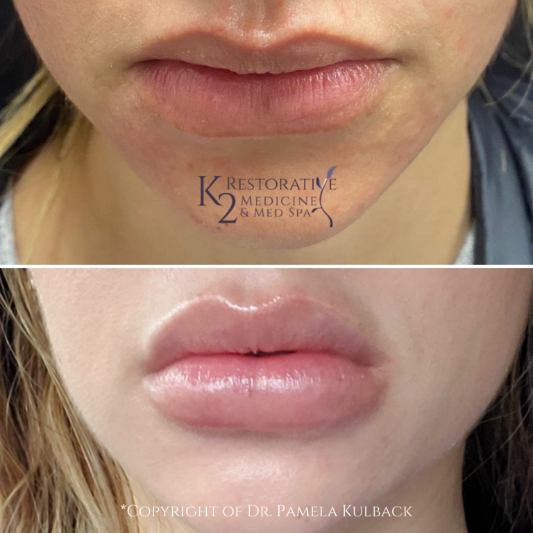 Browse our Before and After Gallery | Dr. Pamela Kulback