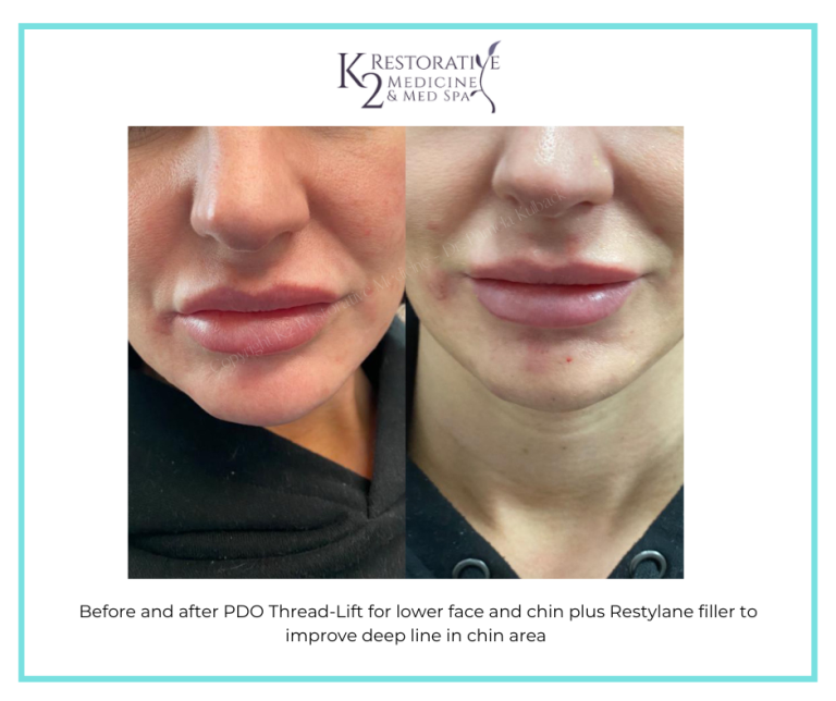 Browse our Before & After Gallery | K2 Restorative Medicine