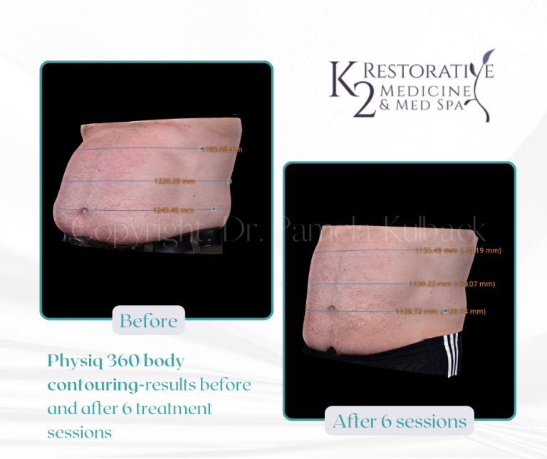 PHYSIQ 360 Body Contouring | Target Fat & Stimulate Muscle