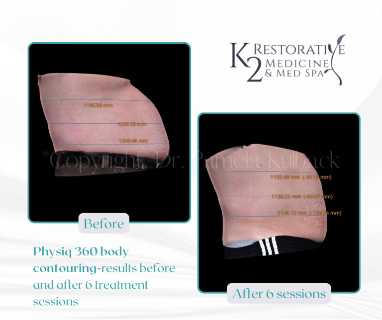 PHYSIQ 360 Body Contouring | Target Fat & Stimulate Muscle