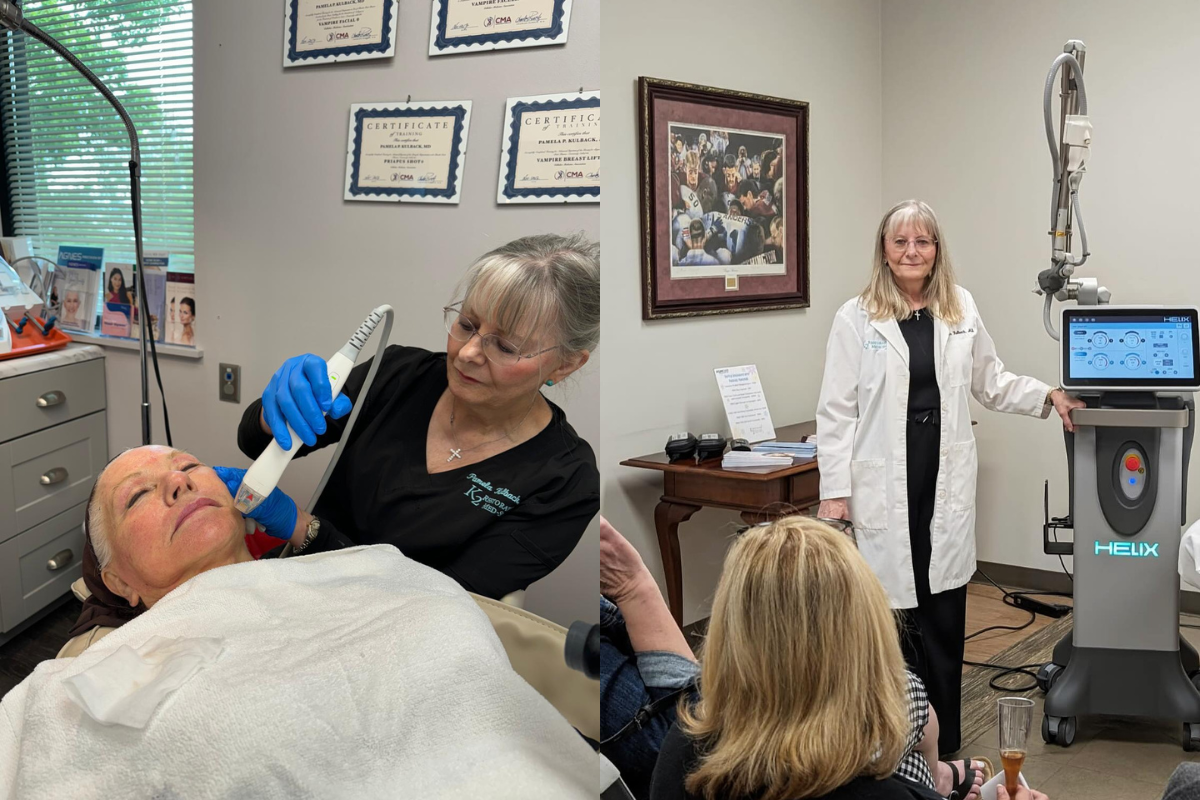 Laser skin resurfacing Birmingham Alabama